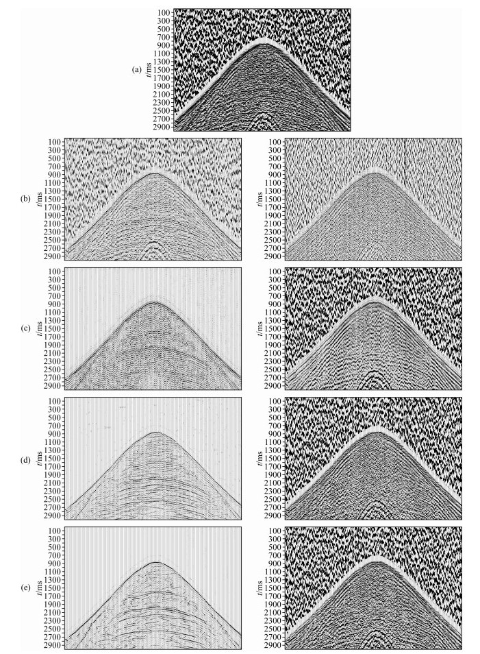 New technology of seismic random noise suppression based on DMFF-Net